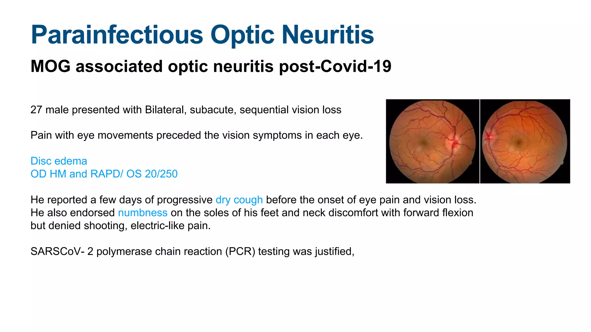 Parainfectious optic neuritis | PPTX