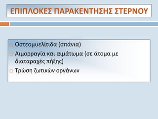 Παρακέντηση στέρνου | PPTX
