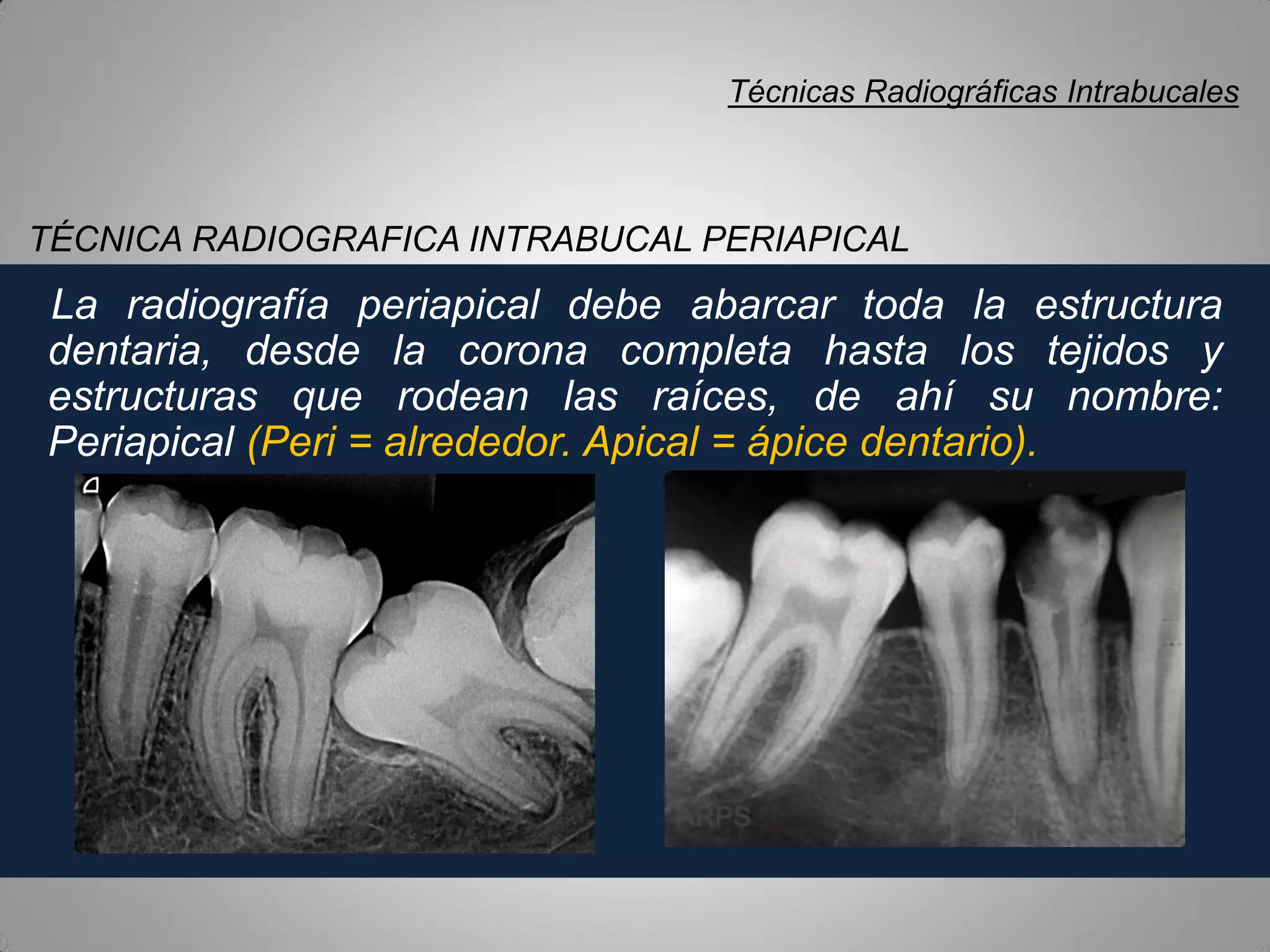 Tecnica radiografica periapical Paralela | PDF