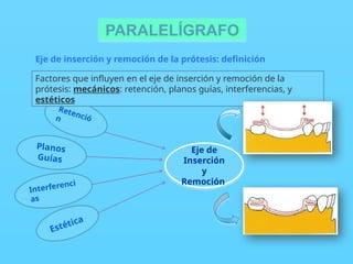 partes y componente del paraleligrafo y su secuencia | PPTX