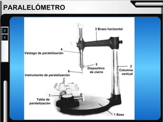 Paralelizacion y biomecanica de prótesis parcial removible | PPT
