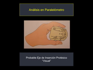 Paralelómetro | PPTX