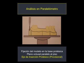 Paralelómetro | PPTX