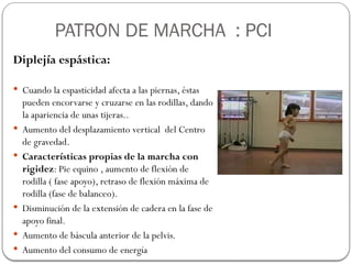 paralisis cerebral infantil caracteristicas y tratamiento.pptx