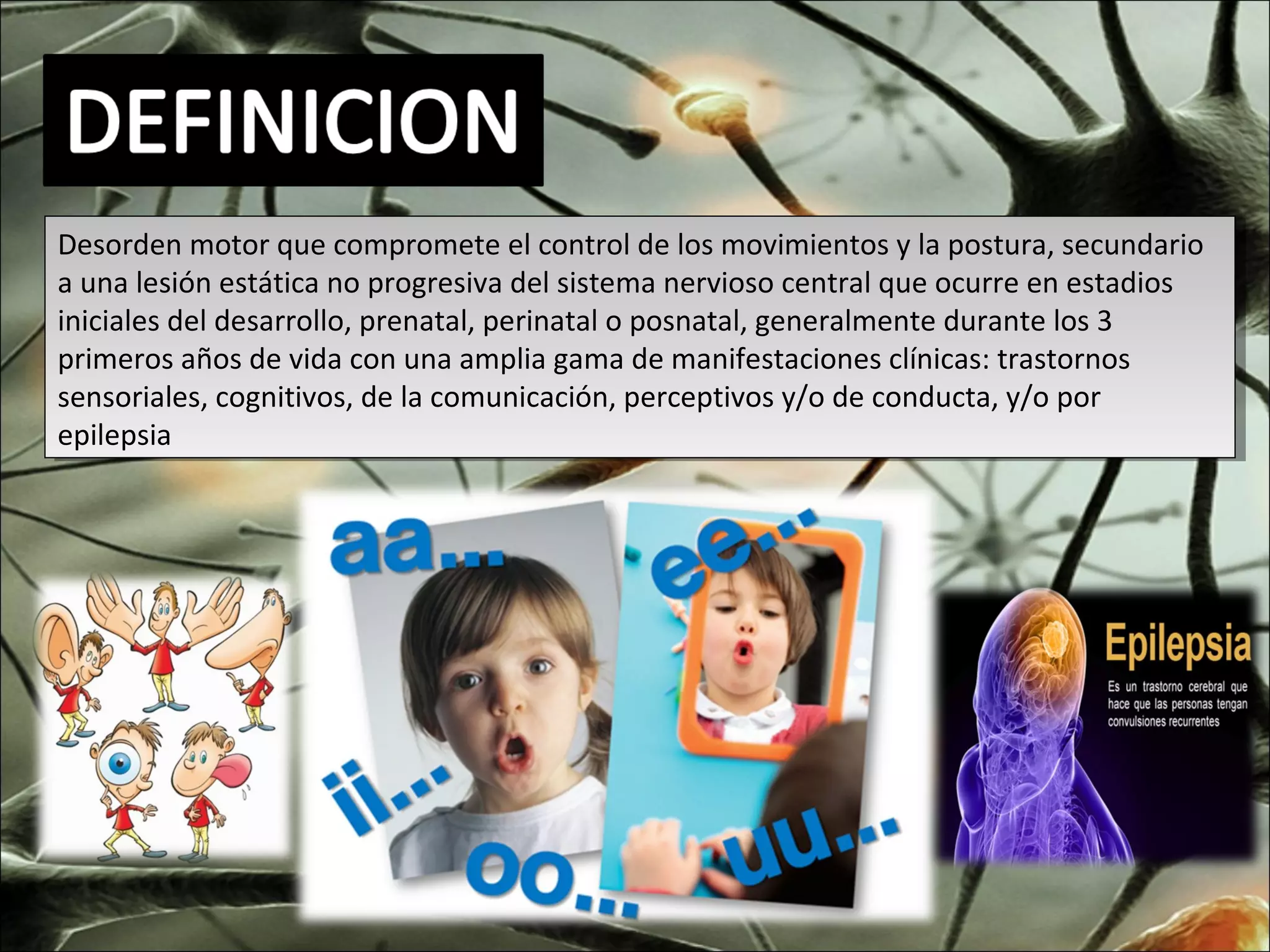Paralisis cerebral infantil | PPT
