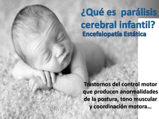 Paralisis Cerebral infantil Dr Jose Brizuela Parte 1 | PPTX