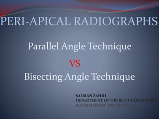 Parallel angle technique vs bisecting angle technique. | PPTX