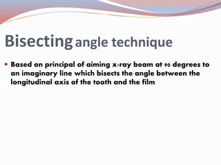 Parallel angle technique vs bisecting angle technique. | PPTX