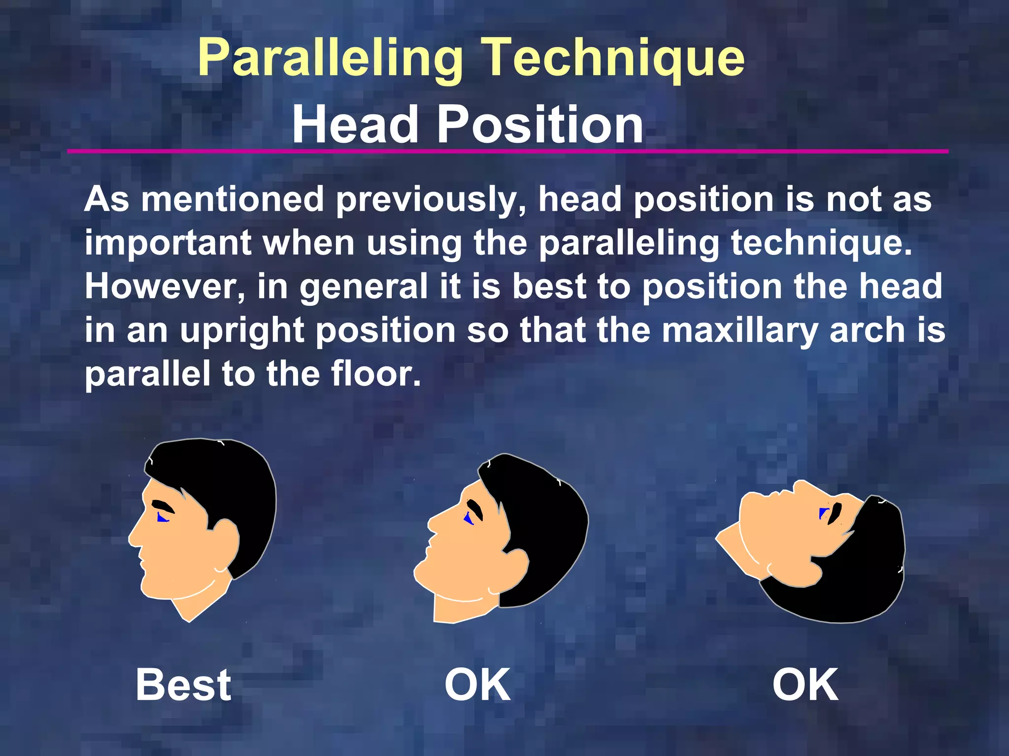 Paralleling technique | PPT