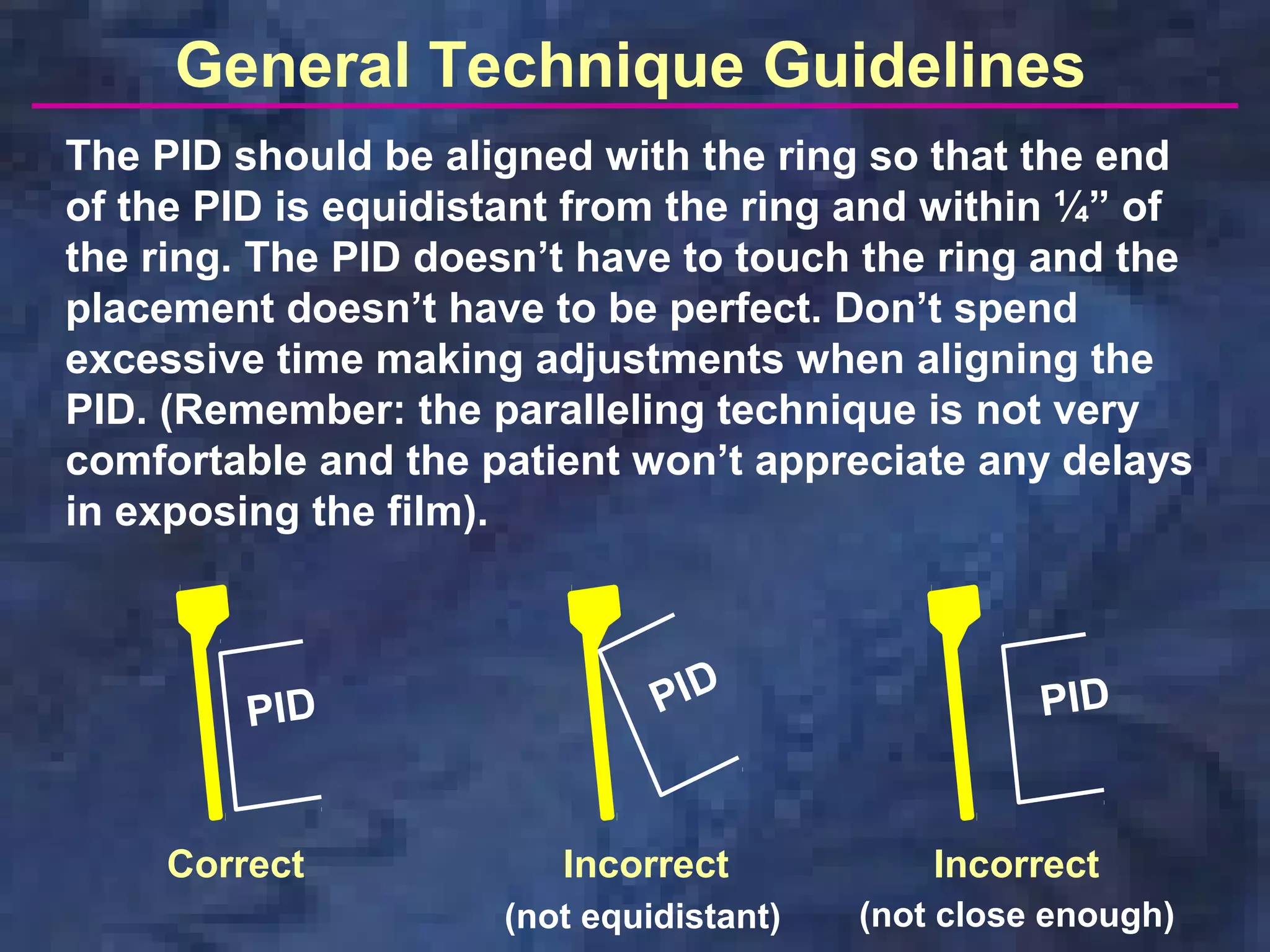 Paralleling technique | PPT