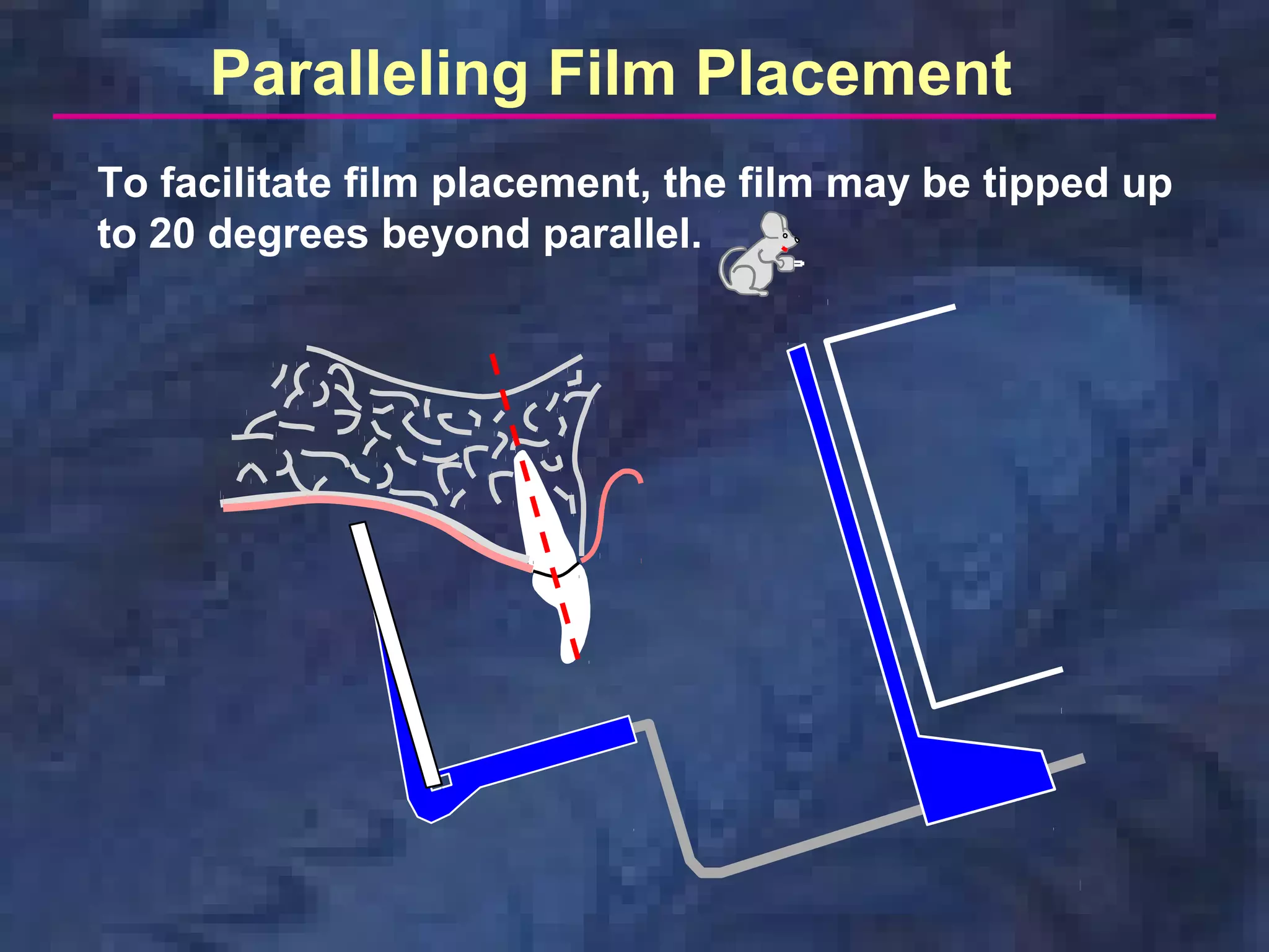 Paralleling technique | PPT