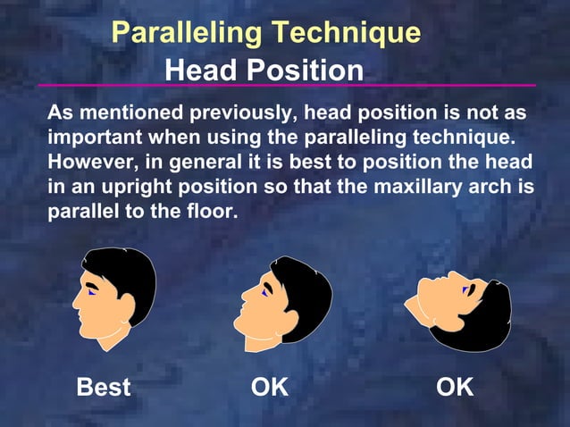 Paralleling technique | PPT