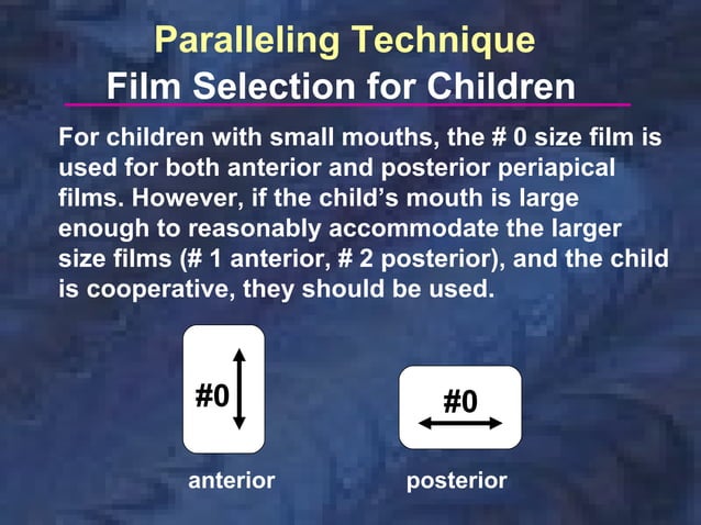 Paralleling technique | PPT