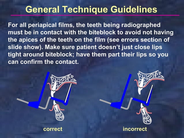 Paralleling technique | PPT