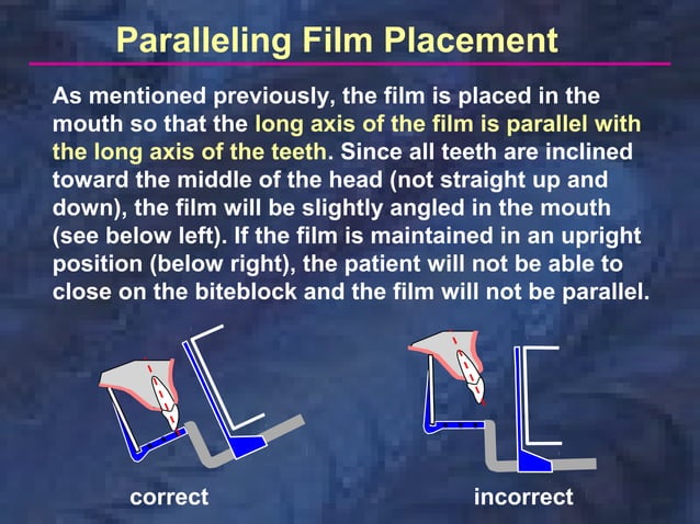 Paralleling technique | PPT