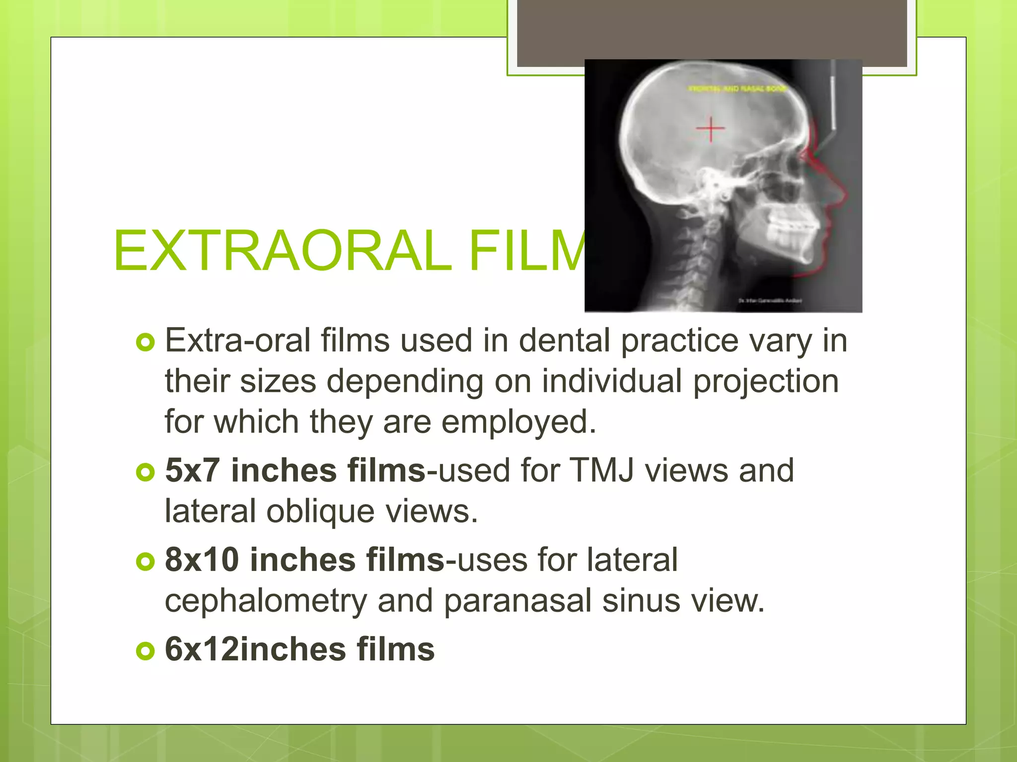 Paralleling and bisecting radiographic techniques | PPTX
