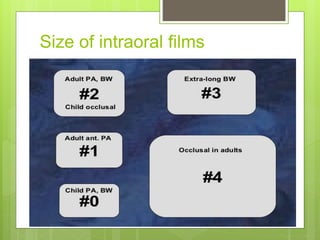 Paralleling and bisecting radiographic techniques | PPTX | Dental ...