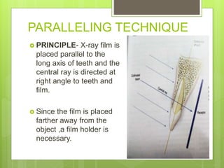 Paralleling and bisecting radiographic techniques | PPTX