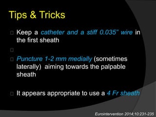 Parallel sheath technique | PPTX