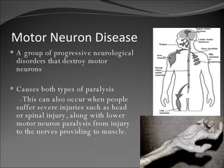 Paralysis | PPT