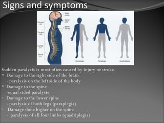 Paralysis | PPT