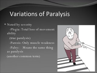 Paralysis | PPT
