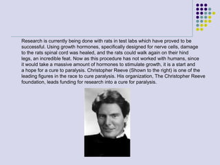 Paralysis | PPTX