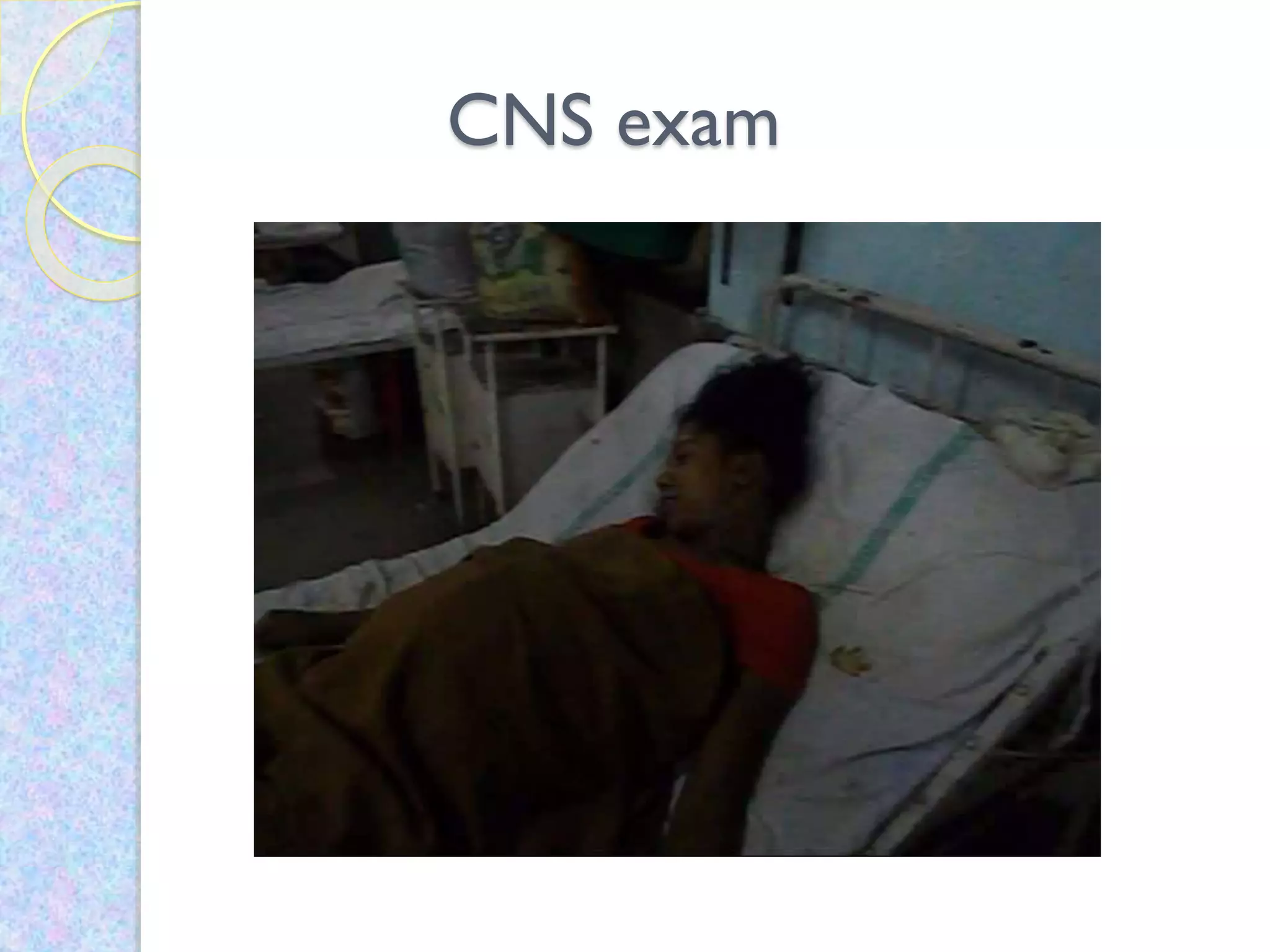 Paralytic RABIES | PPT