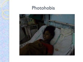 Paralytic RABIES | PPT