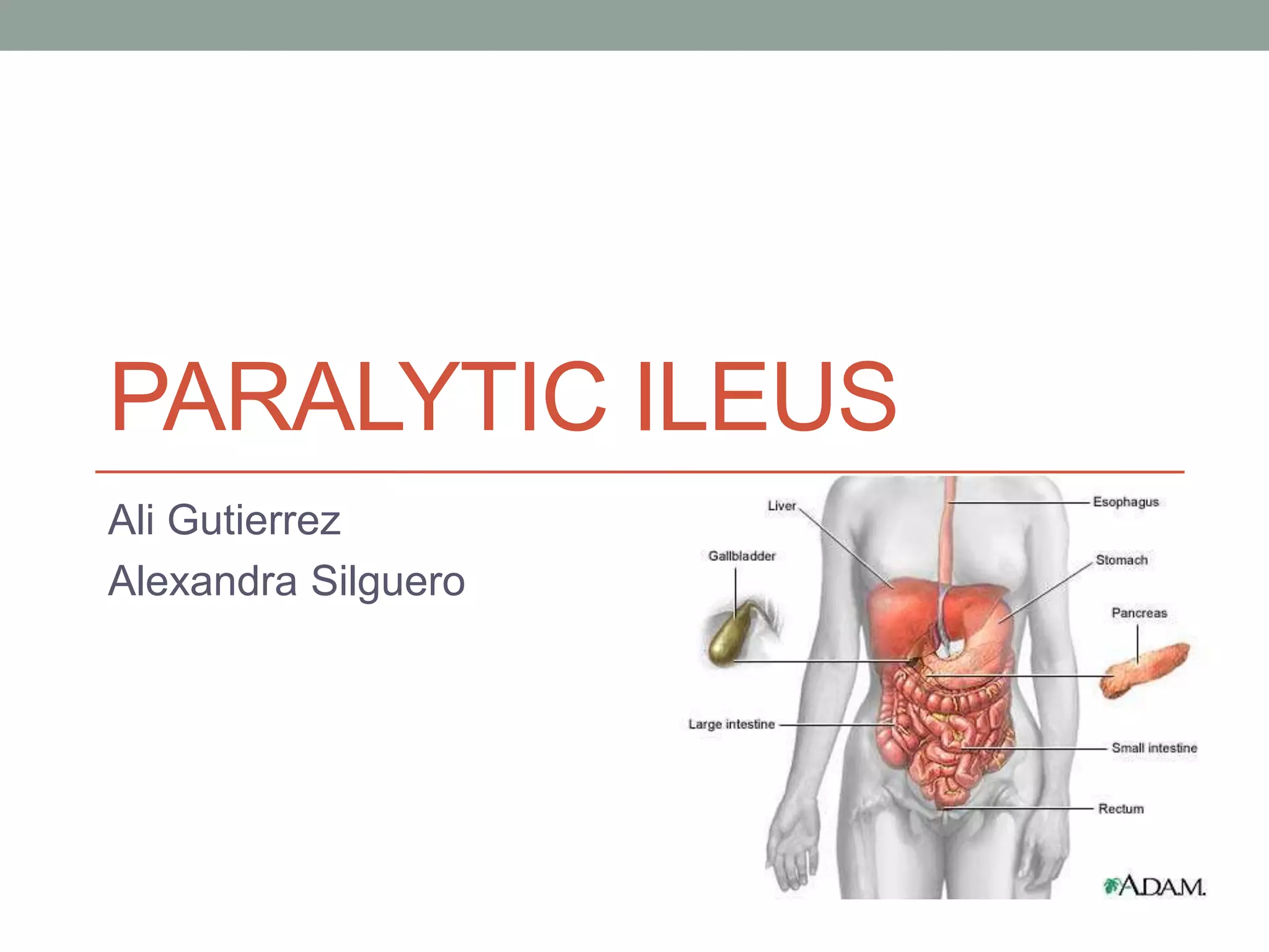 Paralytic ileus | PPTX