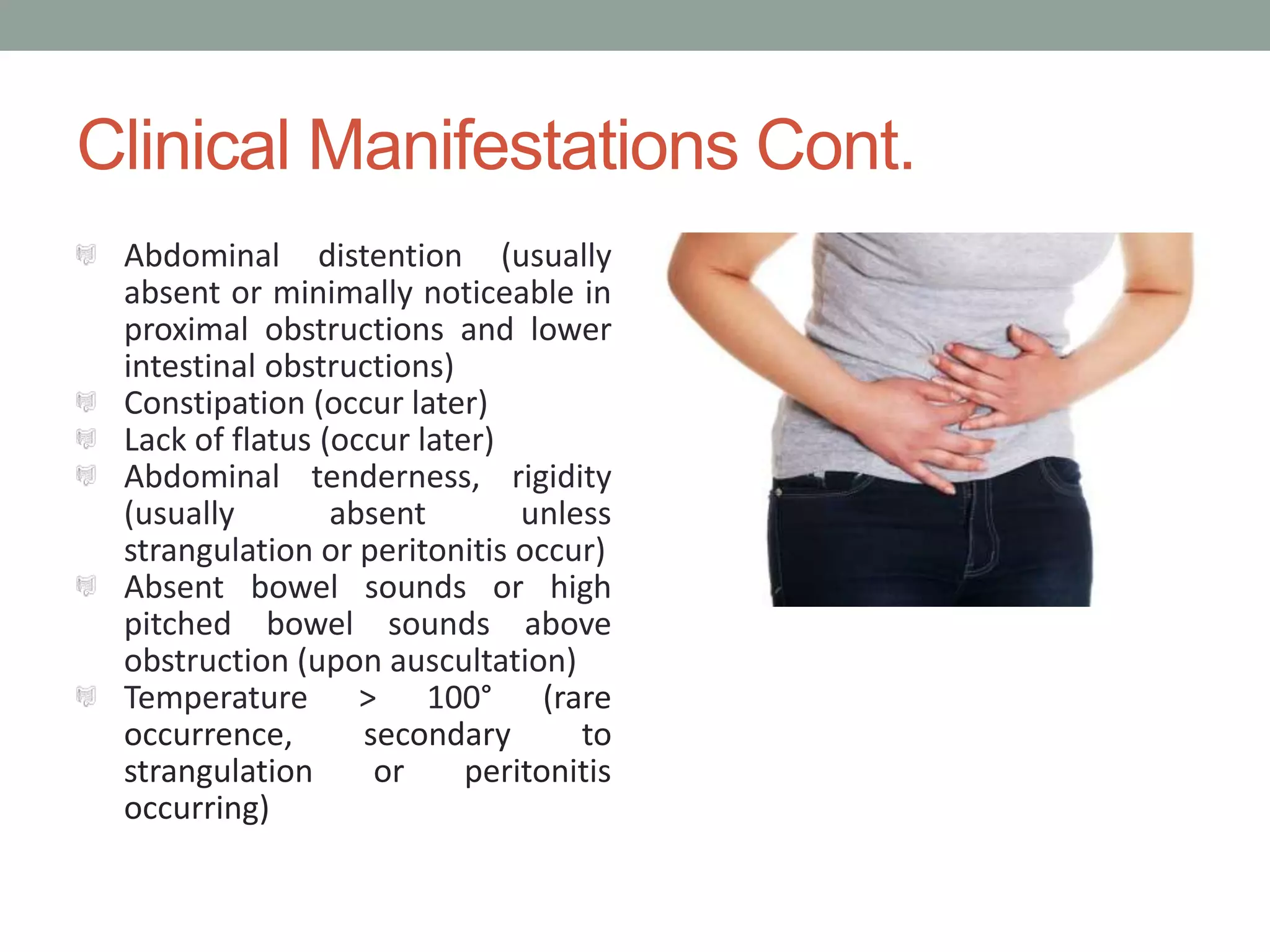 Paralytic ileus | PPTX