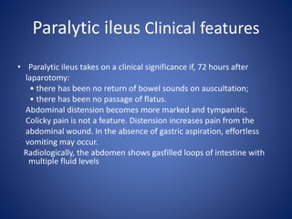 paralytic ileus treatment – ileus ncbi – PJCJZY