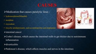 Paralytic ileus | PPTX