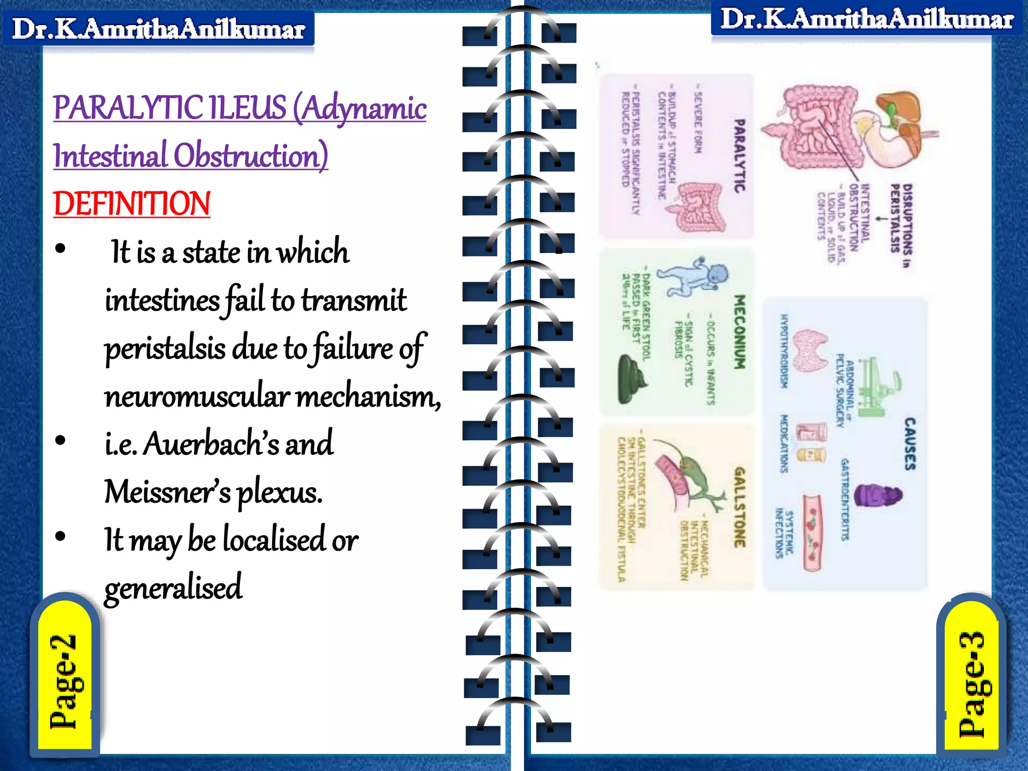 Paralytic ileus (adynamic intestinal obstruction) | PPTX