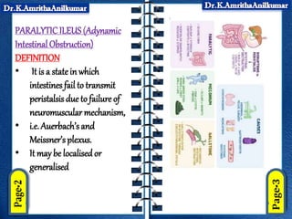 Paralytic ileus (adynamic intestinal obstruction) | PPTX