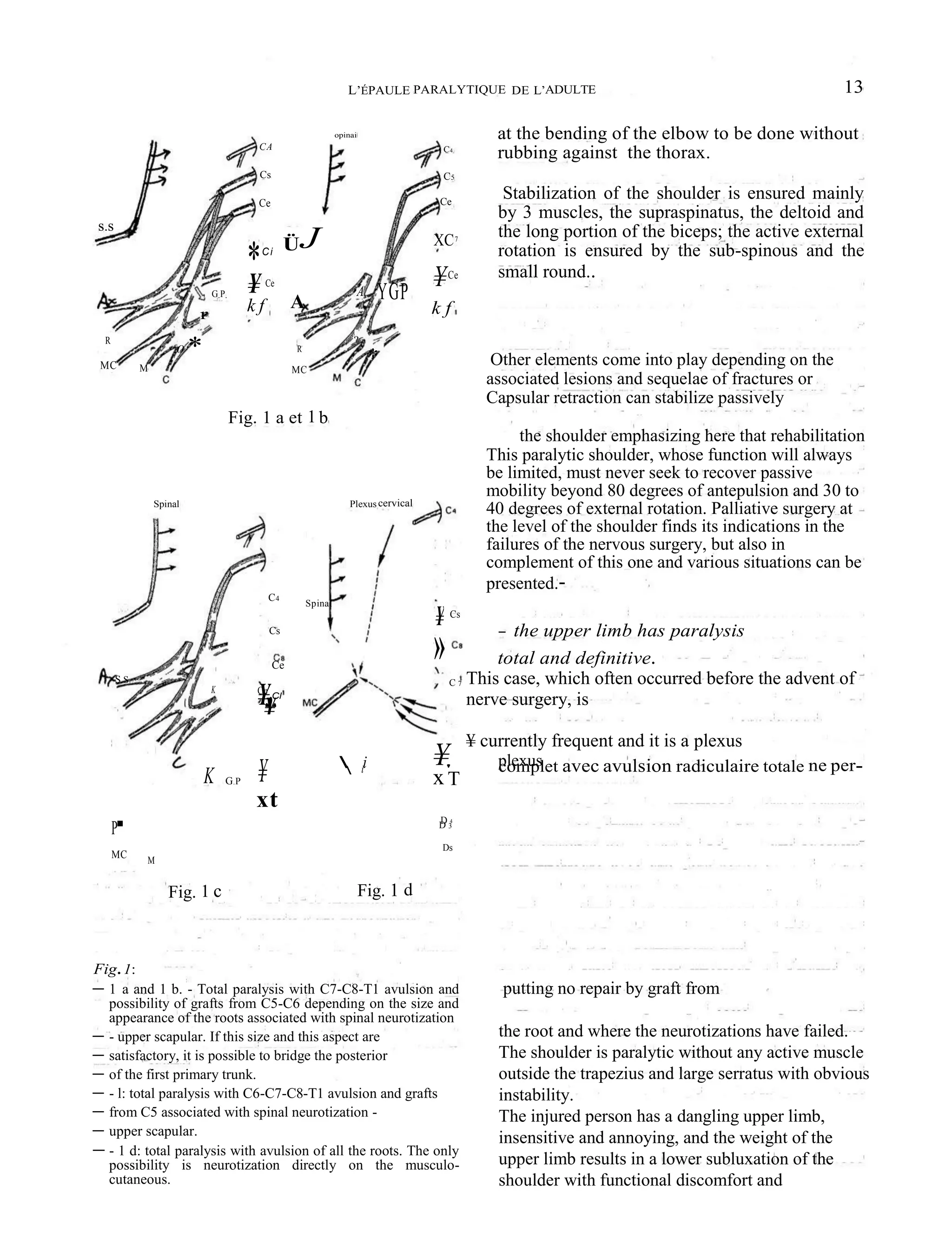 Paralytic shoulder secondary to post traumatic peripheral nerve lesions ...