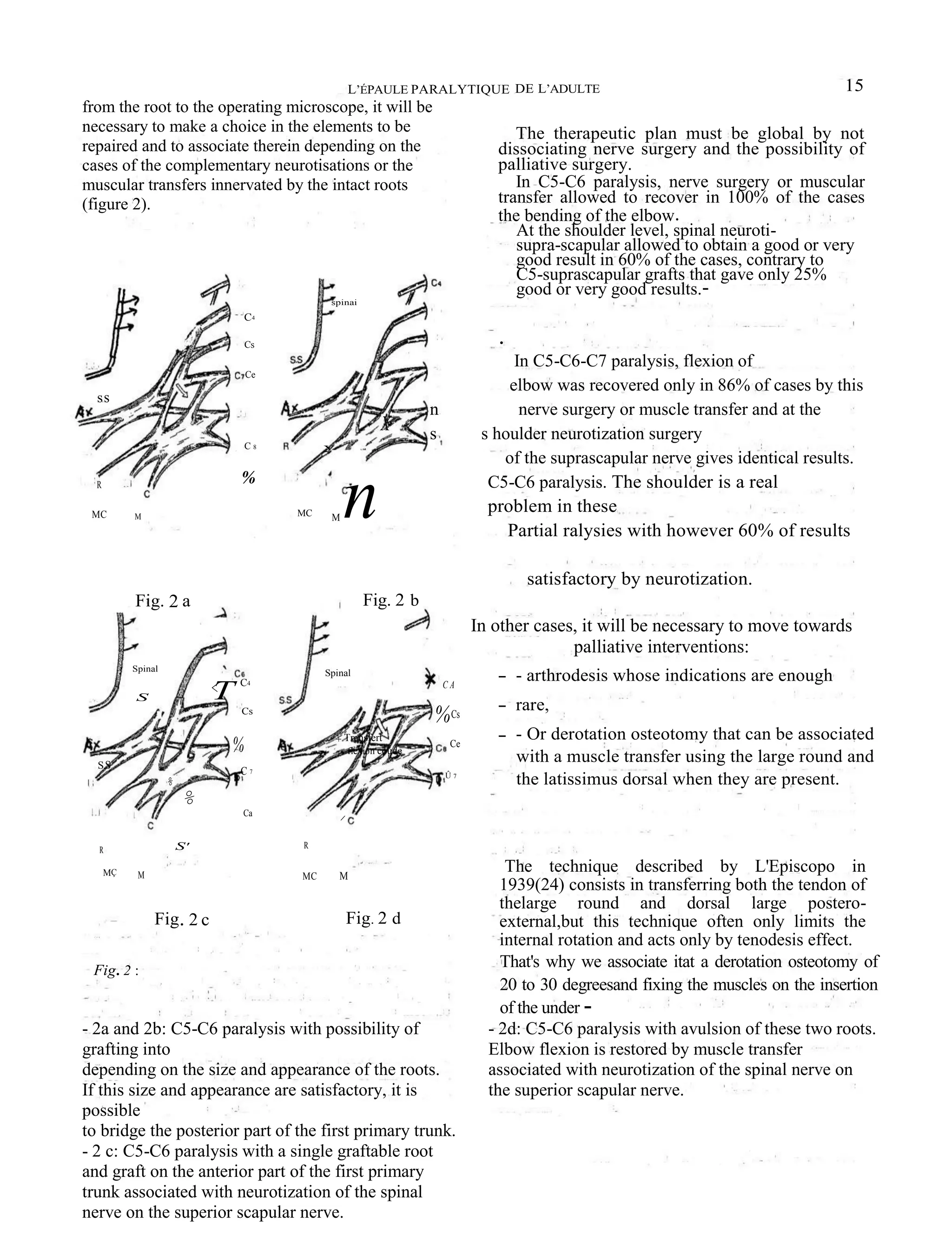 Paralytic shoulder secondary to post traumatic peripheral nerve lesions ...