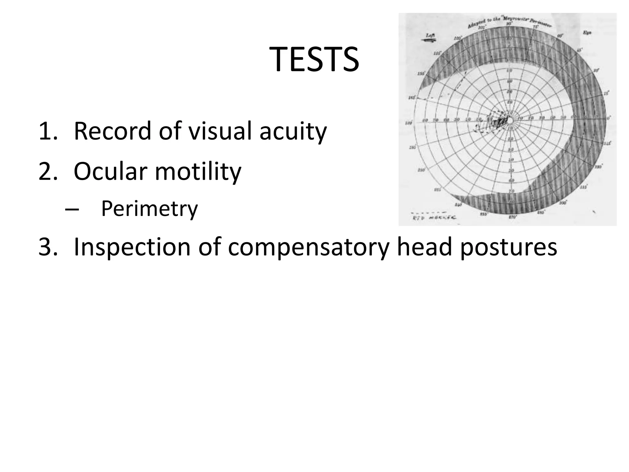 Paralytic squint | PPTX