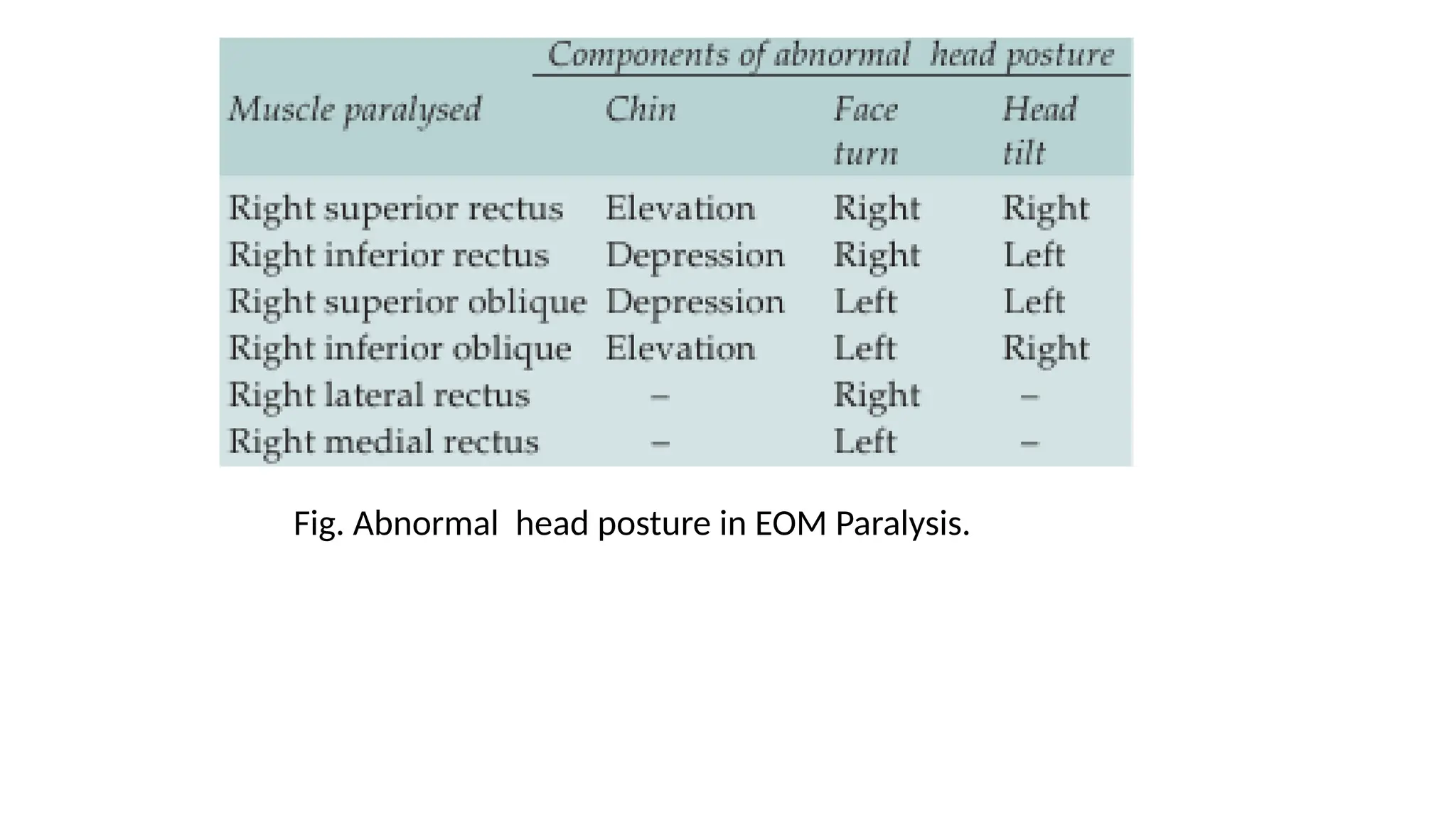 Paralytic Strabismus presentation slideshare.pptx
