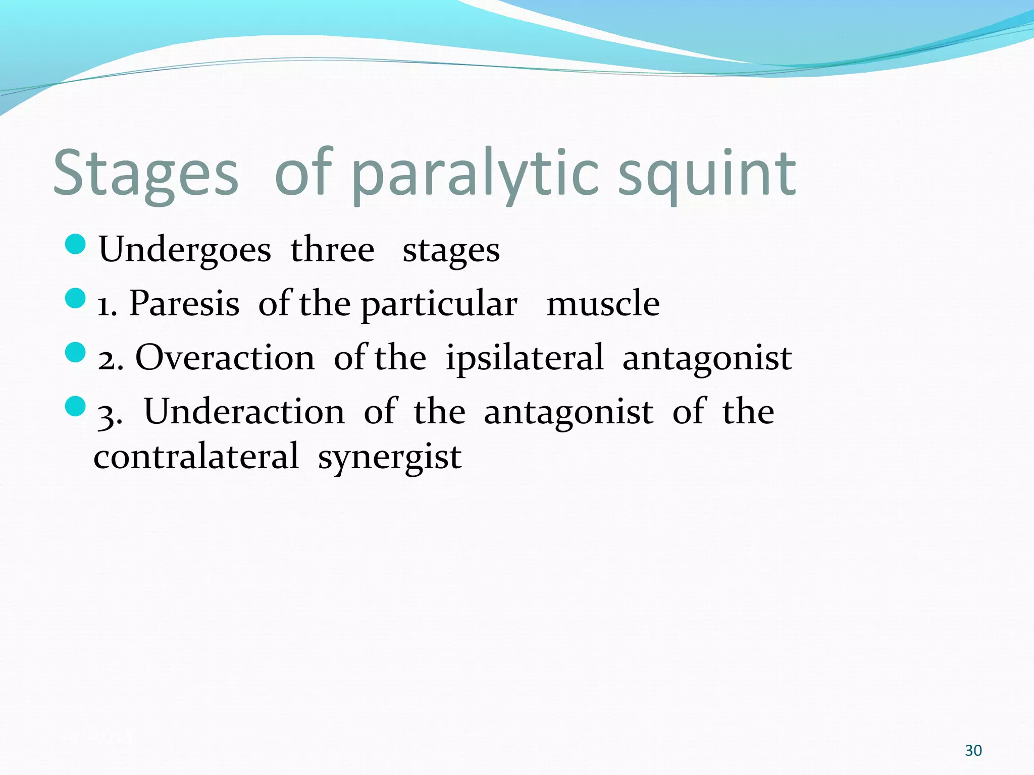 Paralytic strabismus, features and investigations of paretic strabismus ...