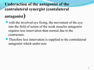 Paralytic strabismus, features and investigations of paretic strabismus ...