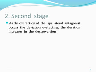 Paralytic strabismus, features and investigations of paretic strabismus ...