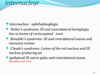 Paralytic strabismus, features and investigations of paretic strabismus ...