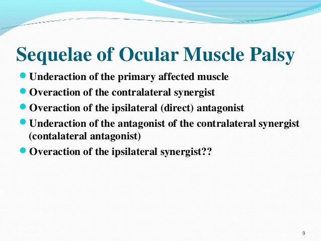 Paralytic strabismus, features and investigations of paretic strabism…