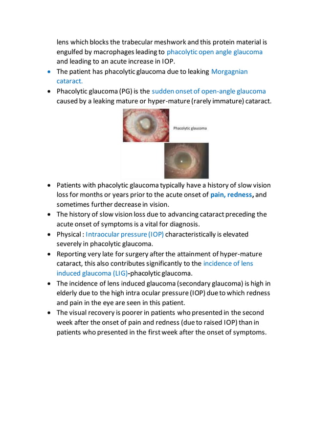 opthalmology case presentation - senile cataract | DOCX | Eye and ...