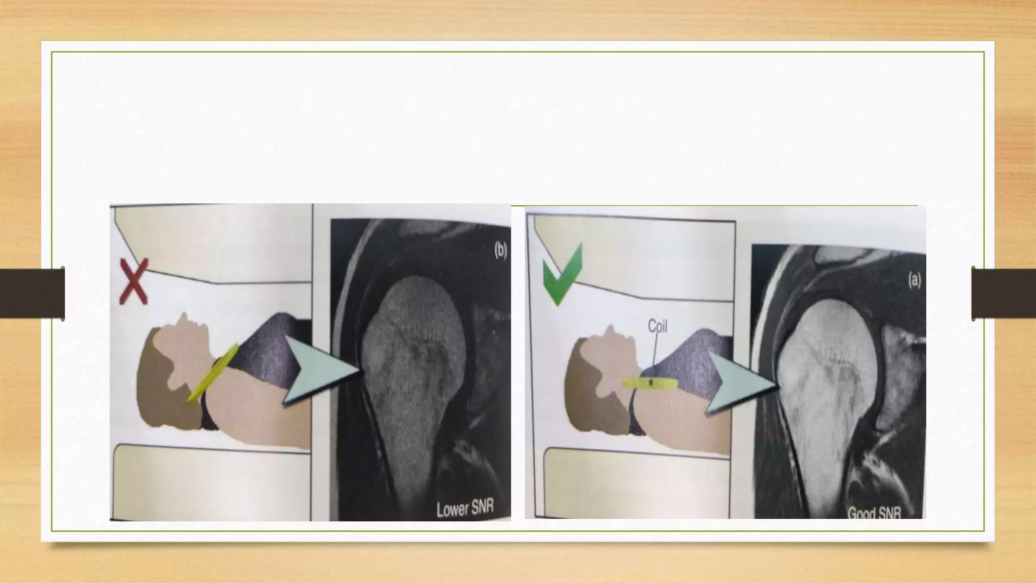 PARAMETERS AND ASSOCIATED Trade-Offs, MRI | PPTX