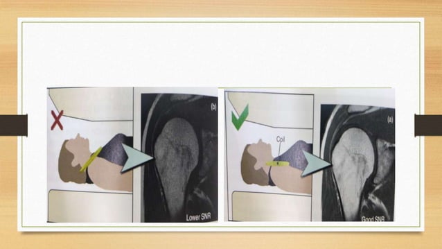 PARAMETERS AND ASSOCIATED Trade-Offs, MRI | PPTX | Digital Audio ...