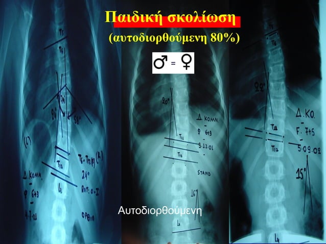 Paramorfosis ss-cyprus-2018 | PPT