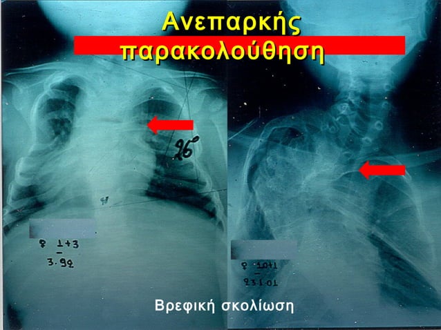 Paramorfosis ss-cyprus-2018 | PPT