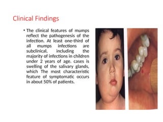 paramyxovirus classification, examples and the infections.pptx